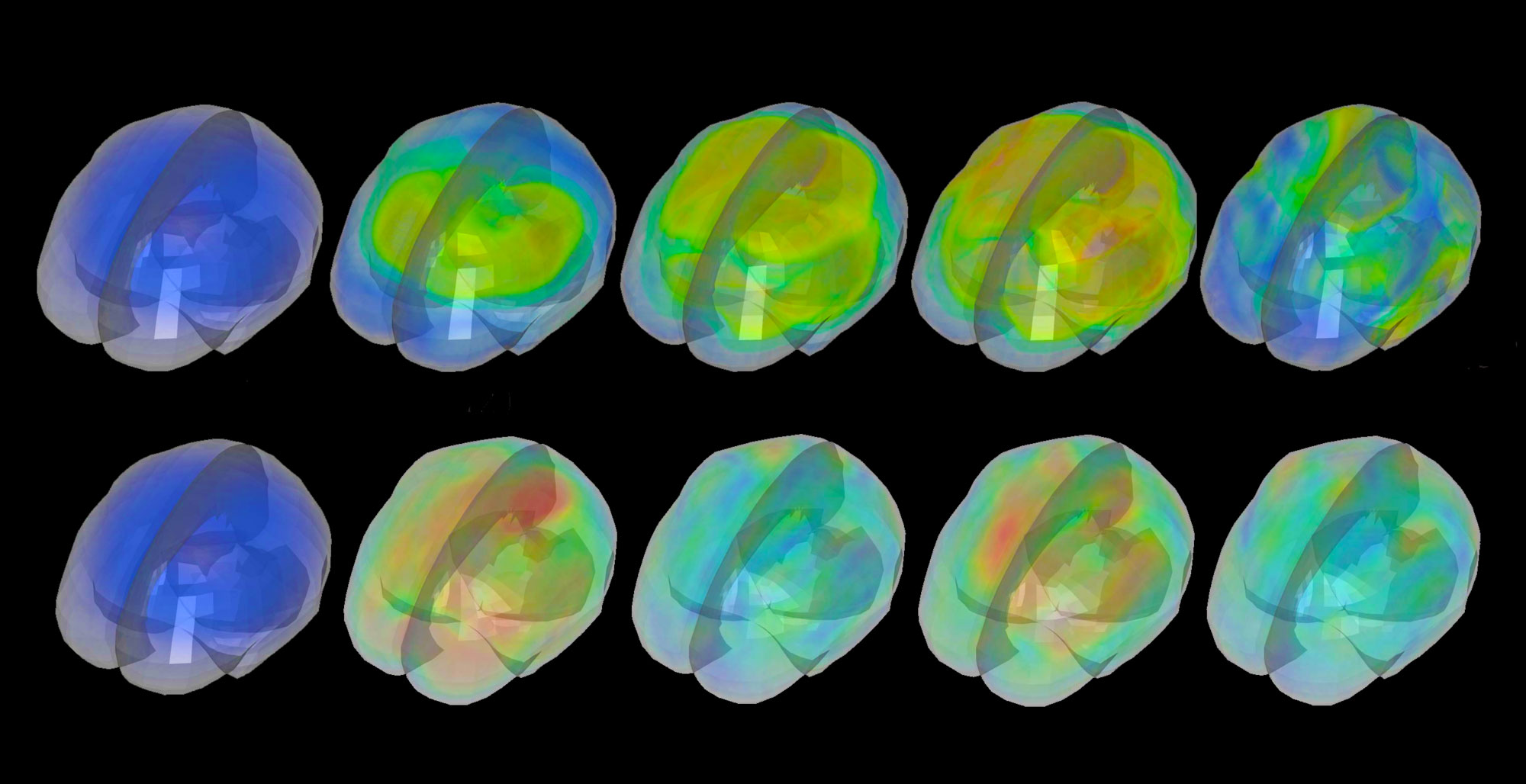 Brain Injury Modeling Reveals Deep Trauma Patterns | News | College of ...